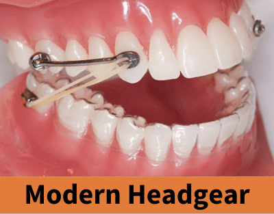Is Headgear Dead? - Joosse Family Orthodontics